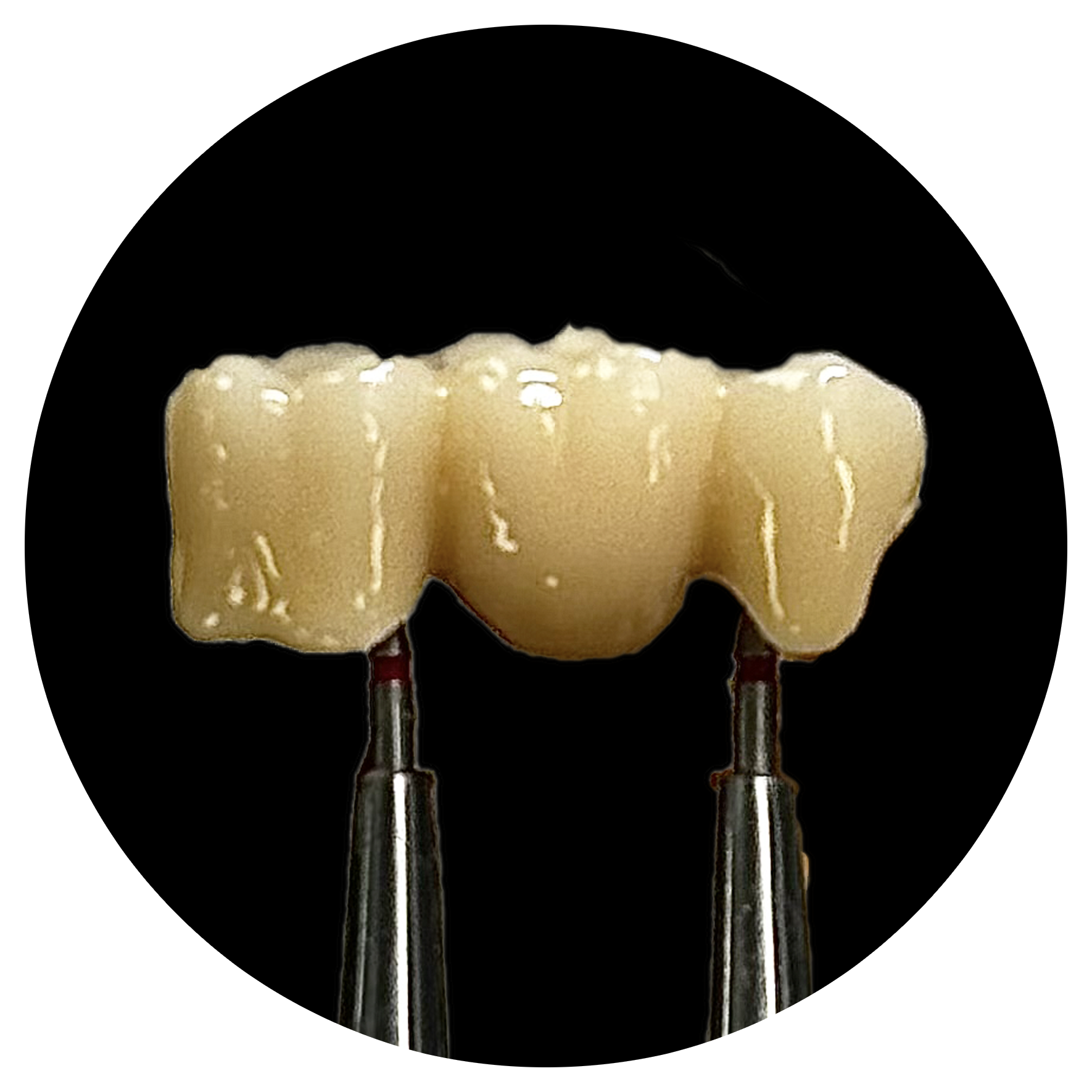 Smile Fusion | Fully Digital Dental Lab for Precision Prosthetics