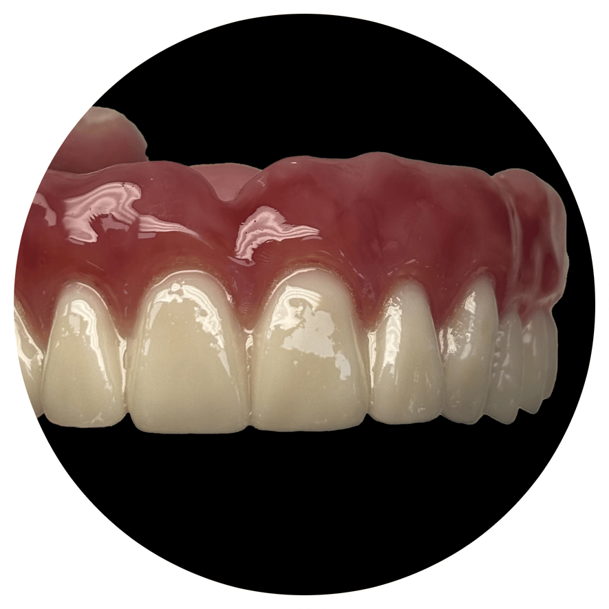 Smile Fusion | Fully Digital Dental Lab for Precision Prosthetics