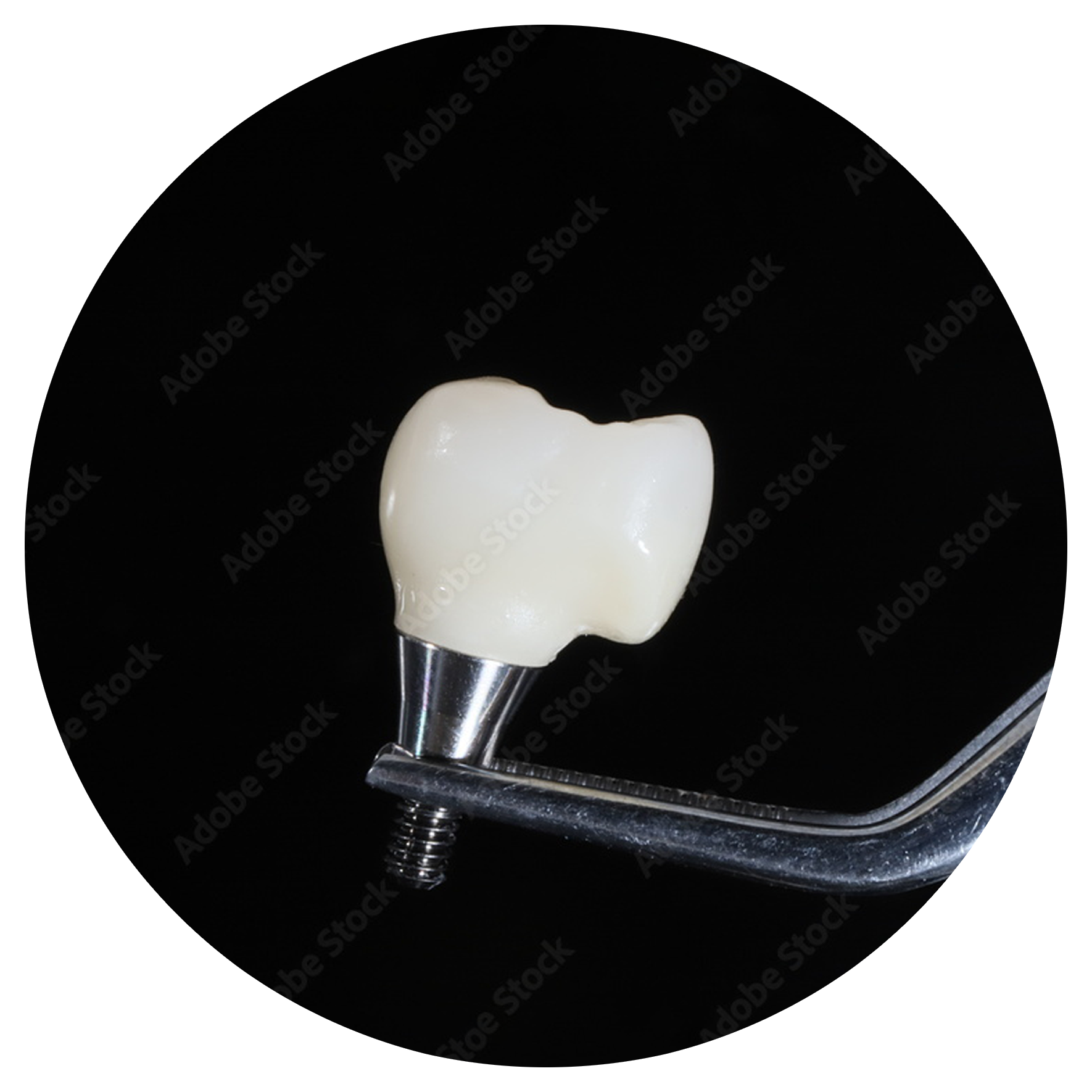 Smile Fusion | Fully Digital Dental Lab for Precision Prosthetics