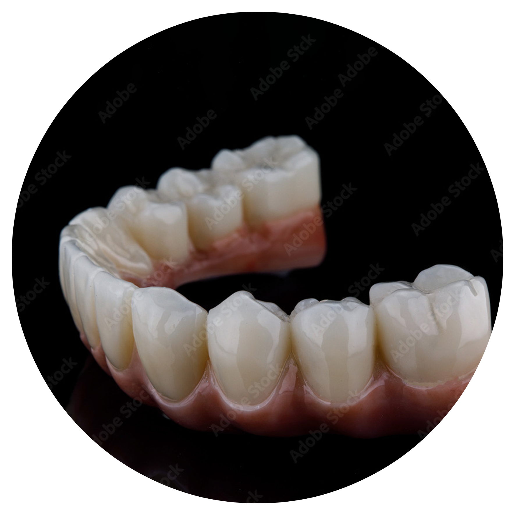 Smile Fusion | Fully Digital Dental Lab for Precision Prosthetics